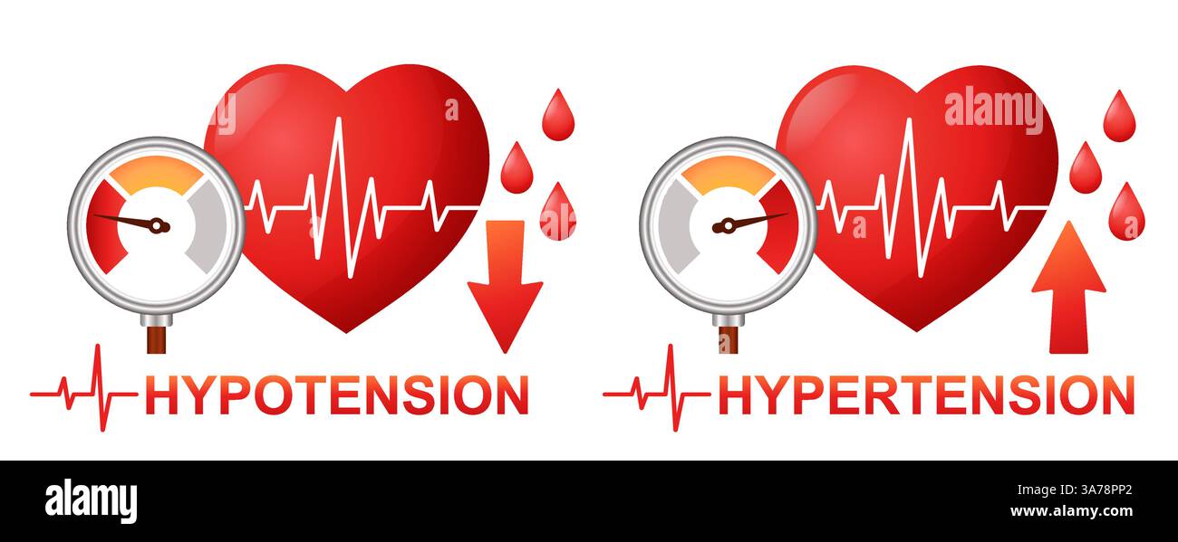 Blood arterial pressure measure, heart hypertension, cardiac ...