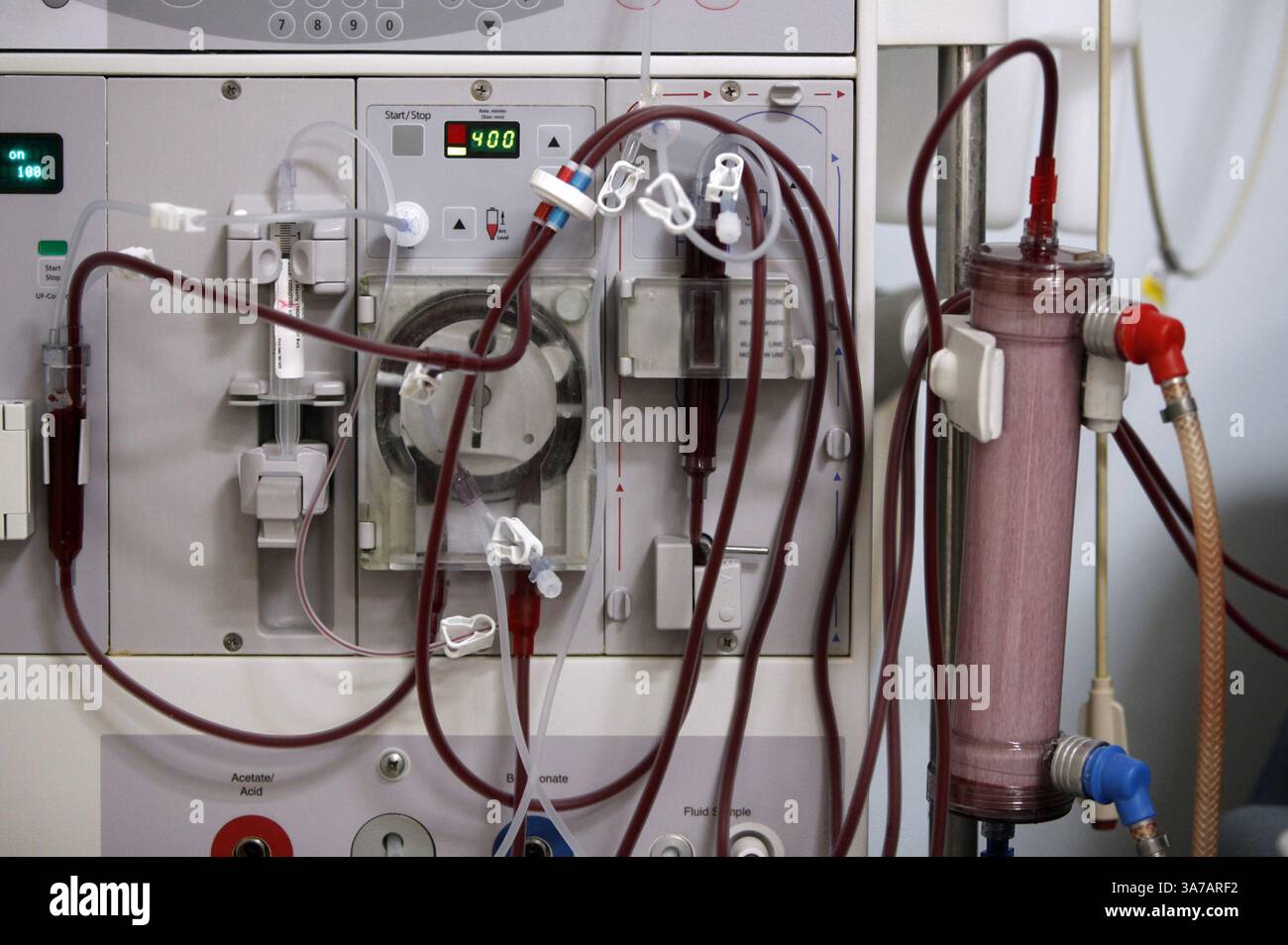 Dialysis filters hi-res stock photography and images - Alamy