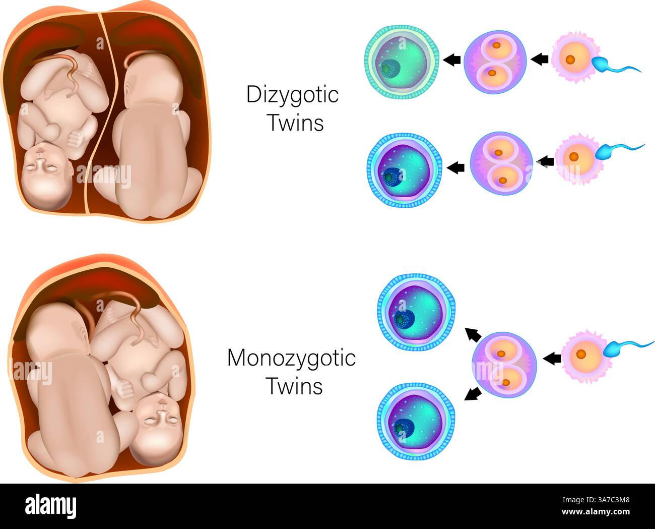 Dizygotic And Monozygotic Twins Hi res Stock Photography And Images Alamy Dizygotic And Monozygotic Twins Hi res Stock Photography And Images Alamy