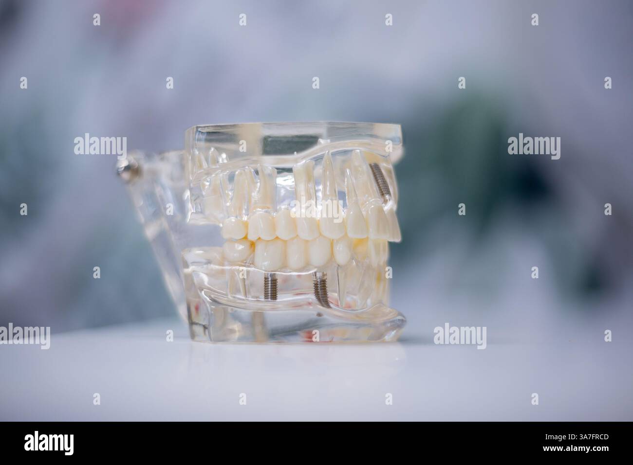 Dental model displaying human teeth, roots, nerves, and dental implants ...