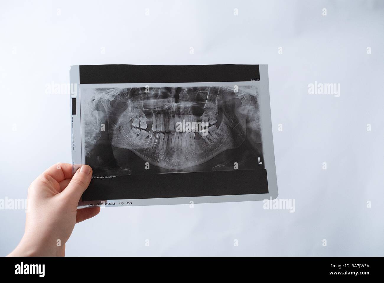 Dental X-ray diagnostics help identify hidden tooth problems and ensure ...