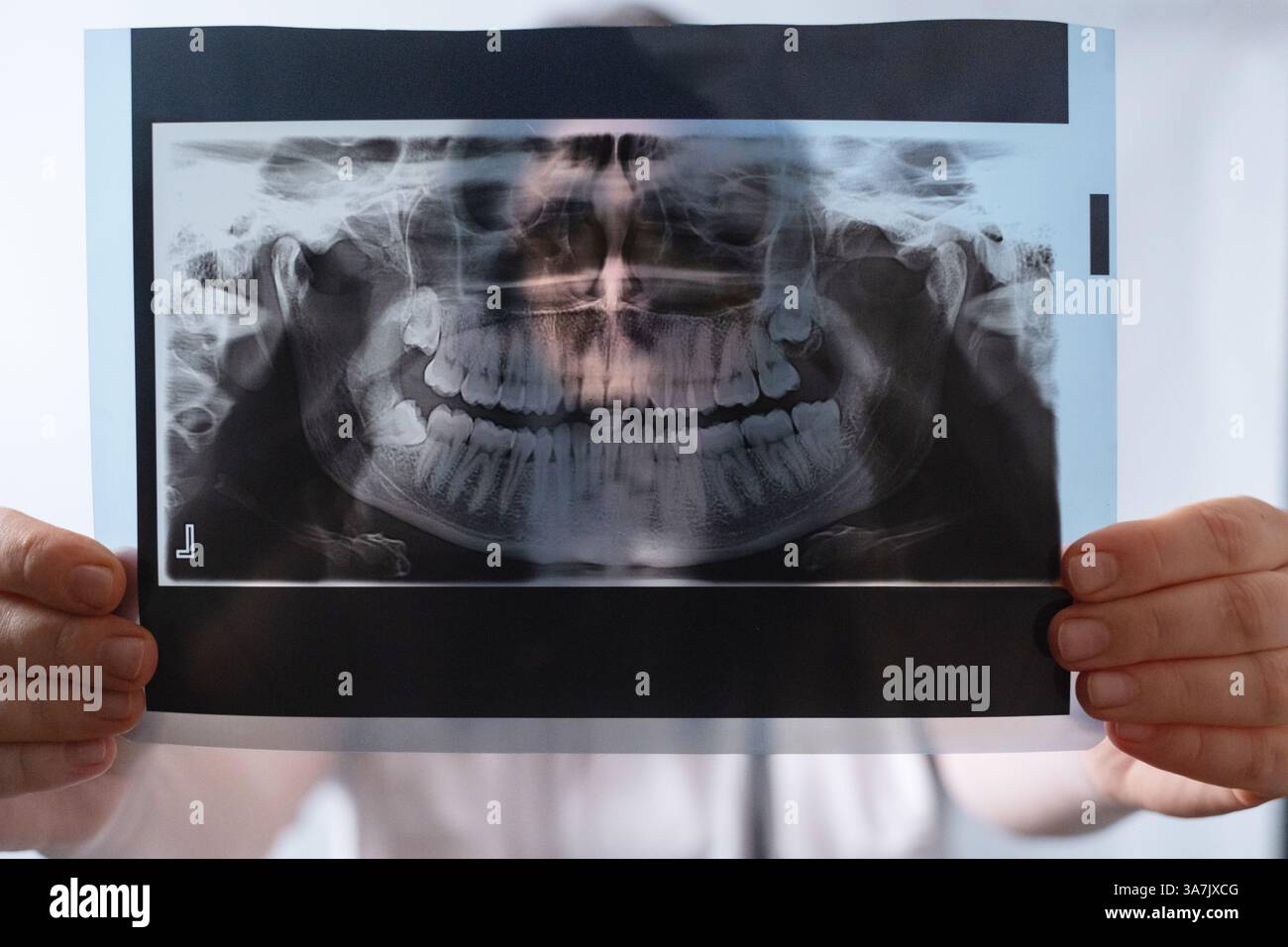 The modern dentist uses an X-ray to detect hidden dental defects and ...