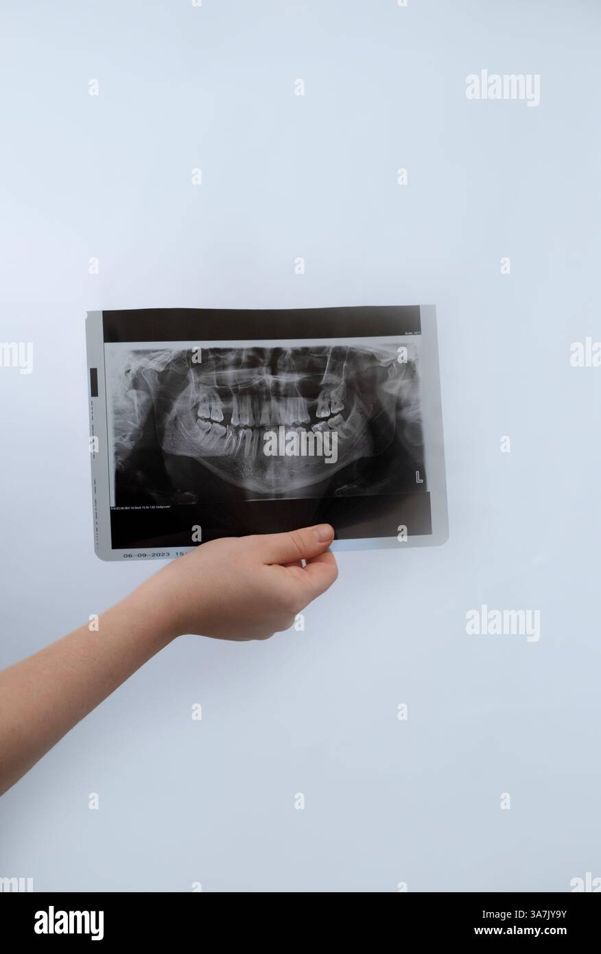 X-ray image is an essential tool for accurate dental examination and ...