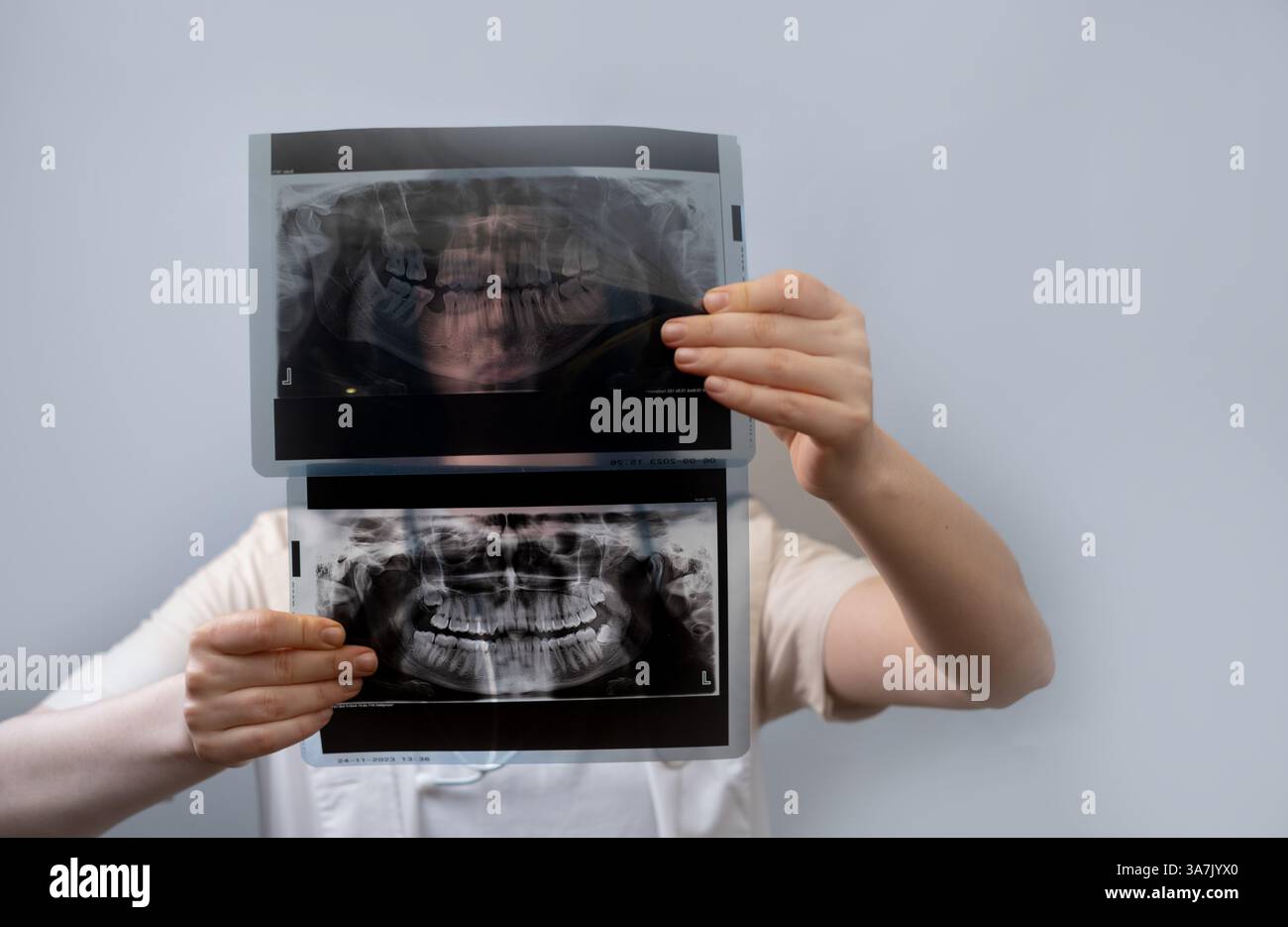 Dental technology: dentist uses X-rays to analyze changes in the ...