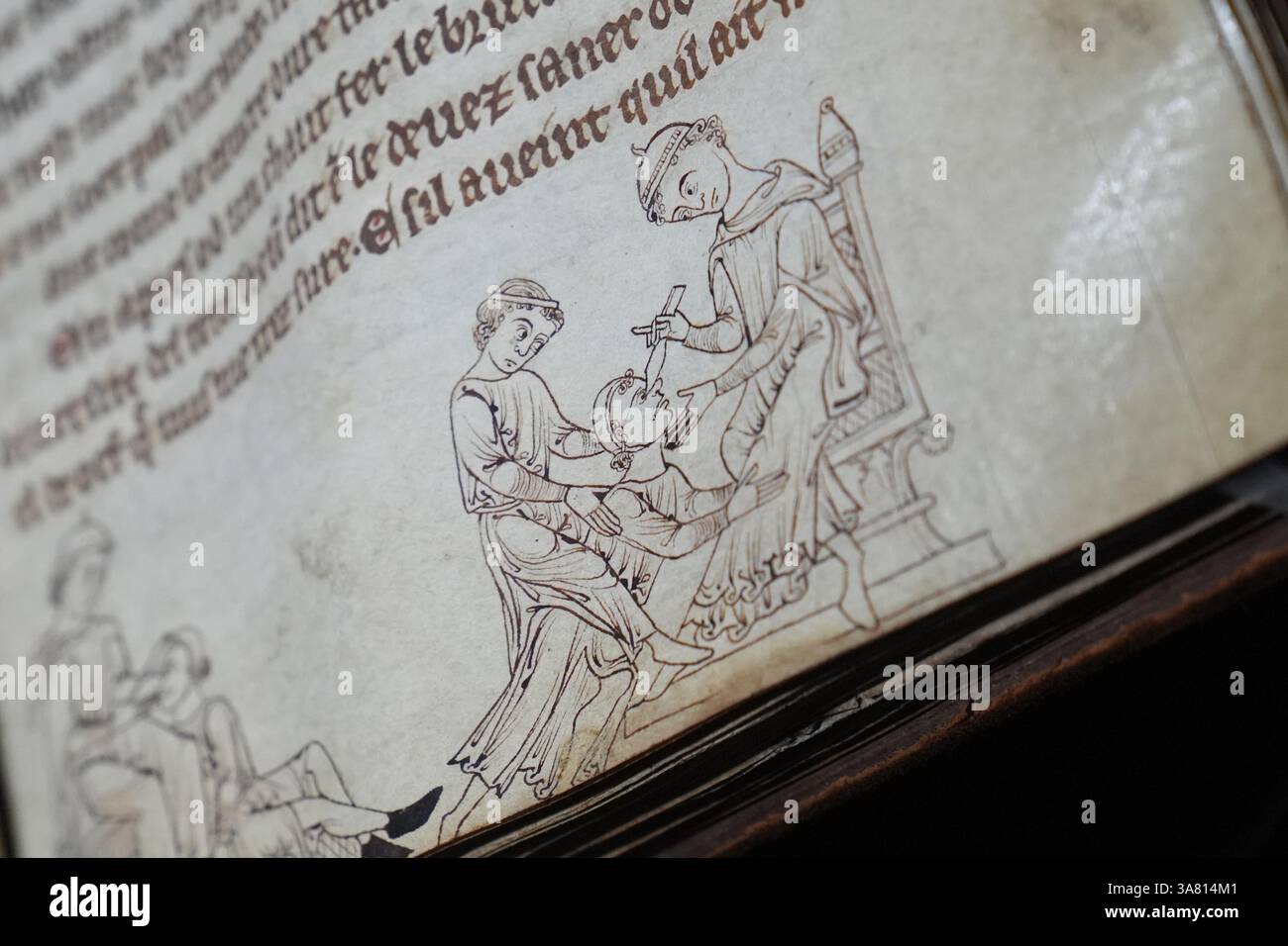 Illustrations in a 13th century manuscript describing a cauterization ...