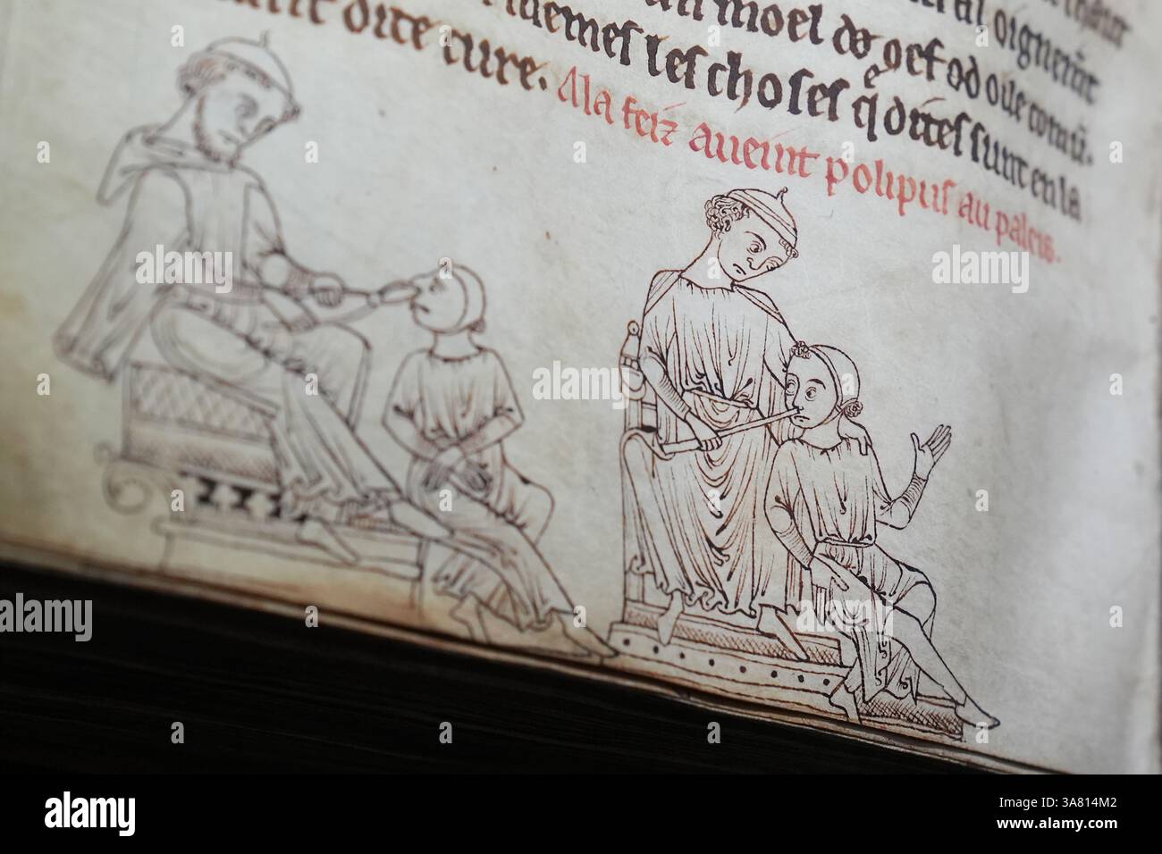 Illustrations in a 13th century manuscript describing a cauterization ...