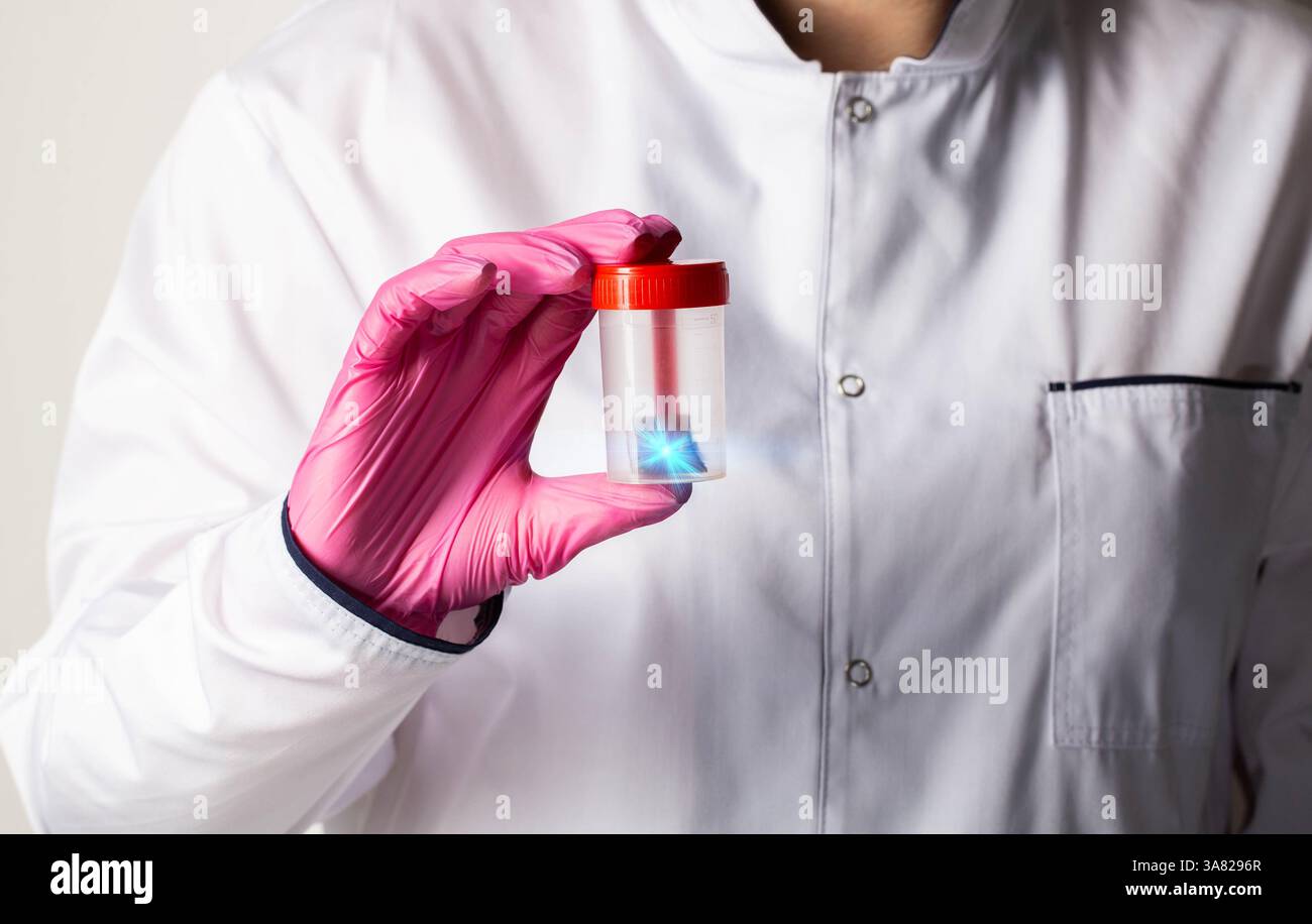 A doctor laboratory assistant holds in his hand a stool test for ...