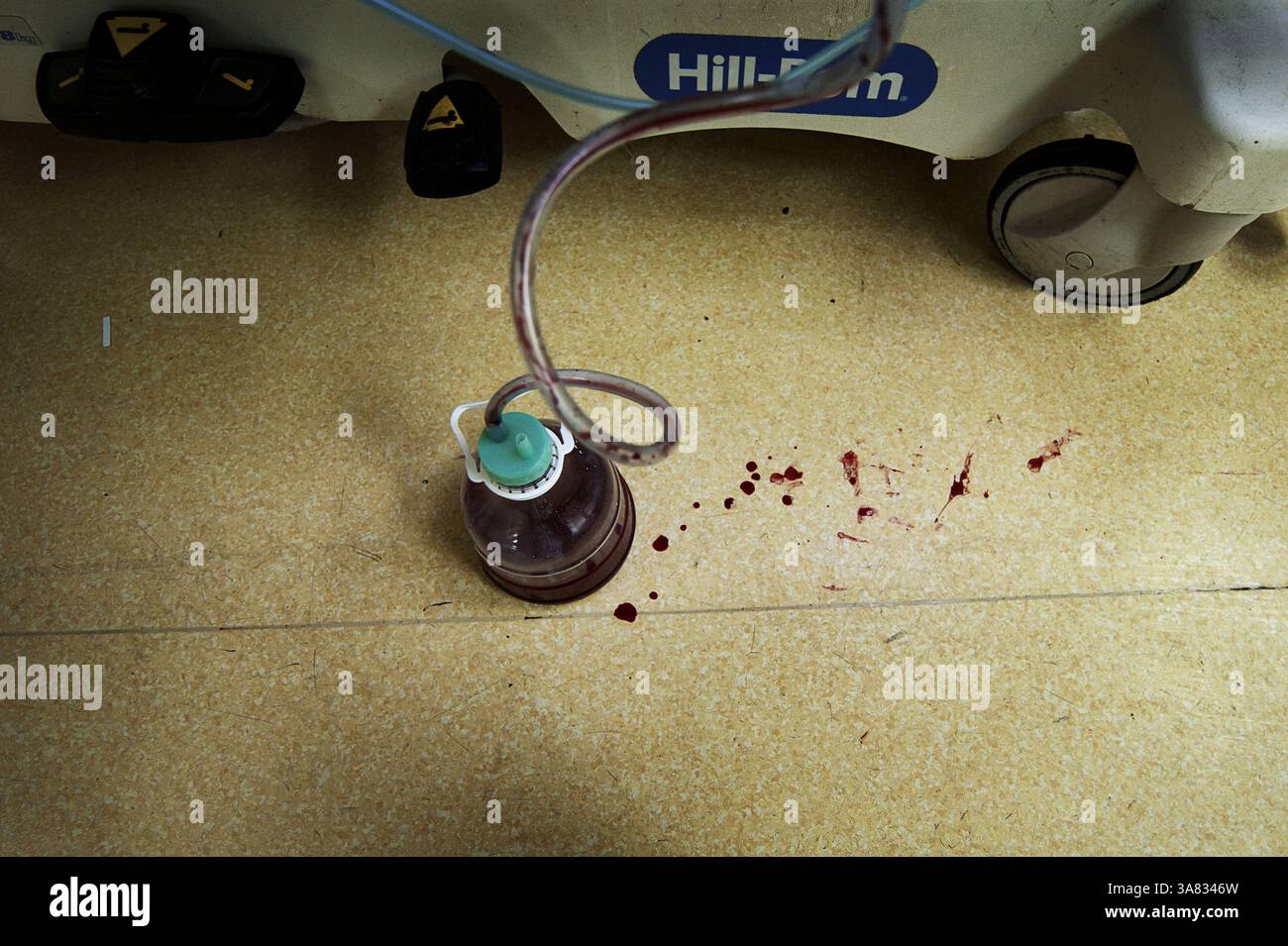 Sept. 16, 2012 - Johannesburg, South Africa - A patient's lungs are ...
