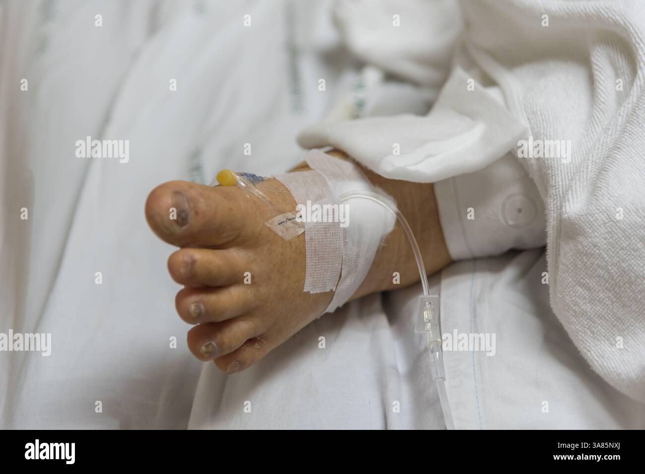 Patient in the hospital with saline intravenous on a elderly patient ...