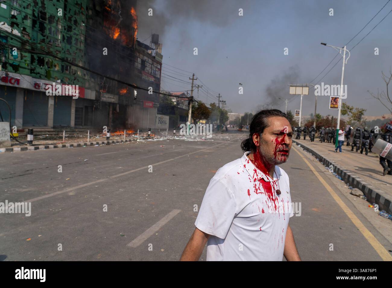 An injured pro-monarchist supporter stands in front of blazed house by ...