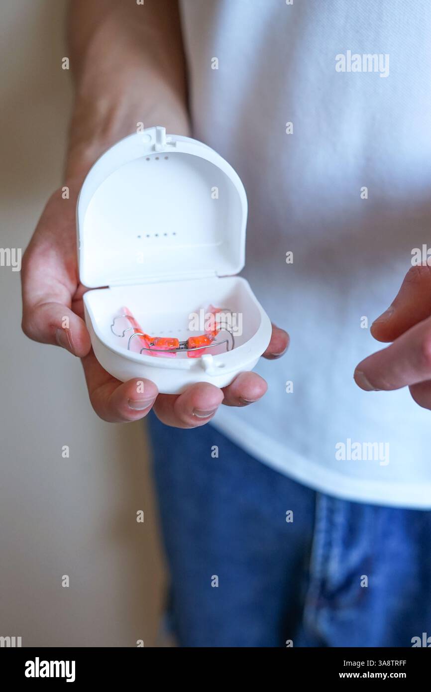 A person holding an open orthodontic retainer case with a palatal ...