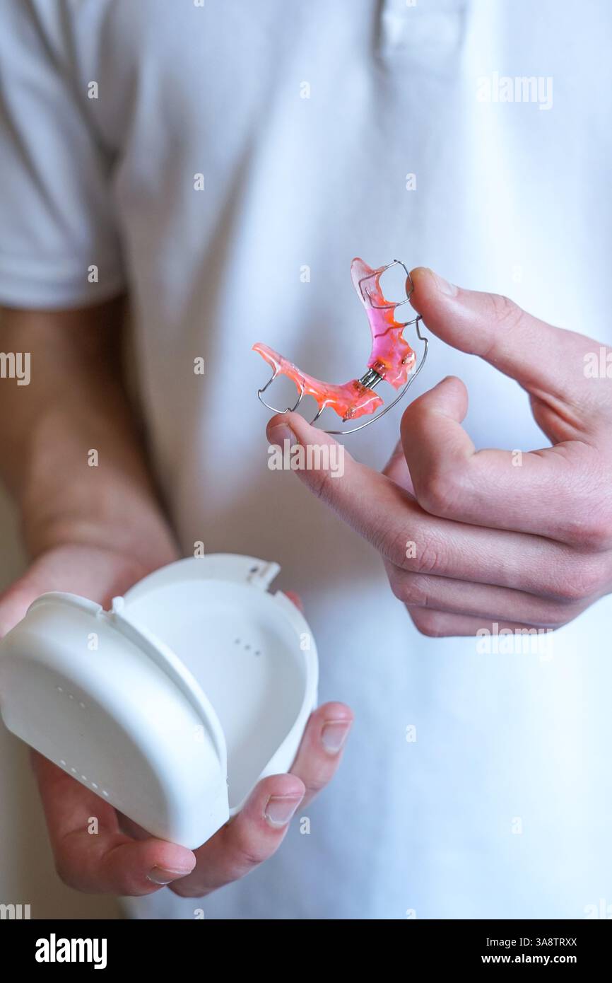 A close-up of a hand holding an orthodontic Palatal Expander , a device ...