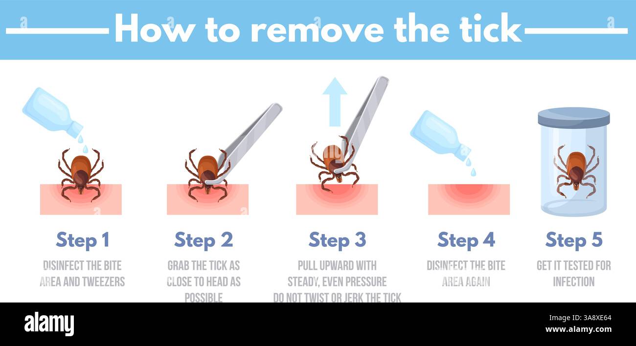 Tick removal. How to remove ticks insect infographics banner, mite bug ...
