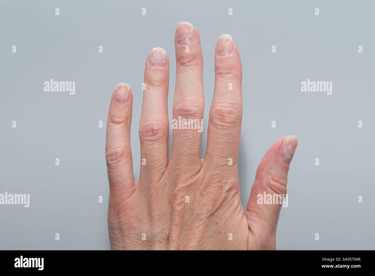 A detailed close-up of an elderly person's hand with visible wrinkles ...