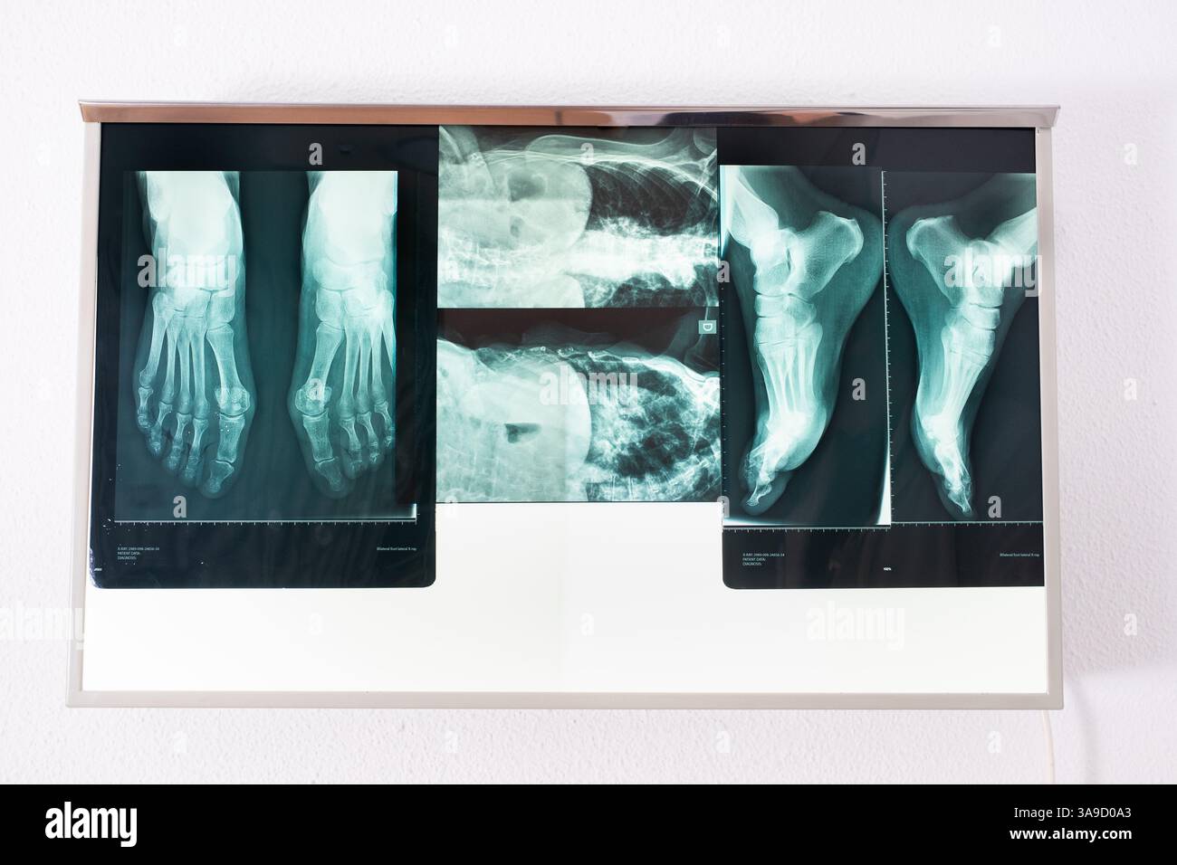 General view of a Viewing Box of radiographs of the consultation of a ...
