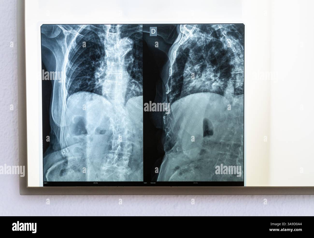 View in detail of a Viewing Box of radiographs of the consultation of a ...