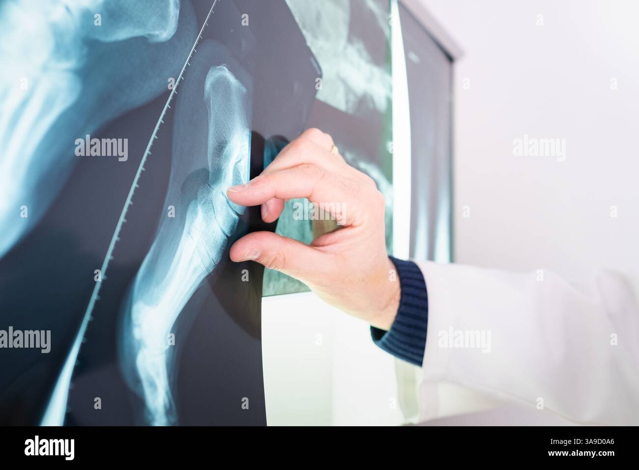 Detail of the hand of a doctor wearing a white coat measuring a detail ...