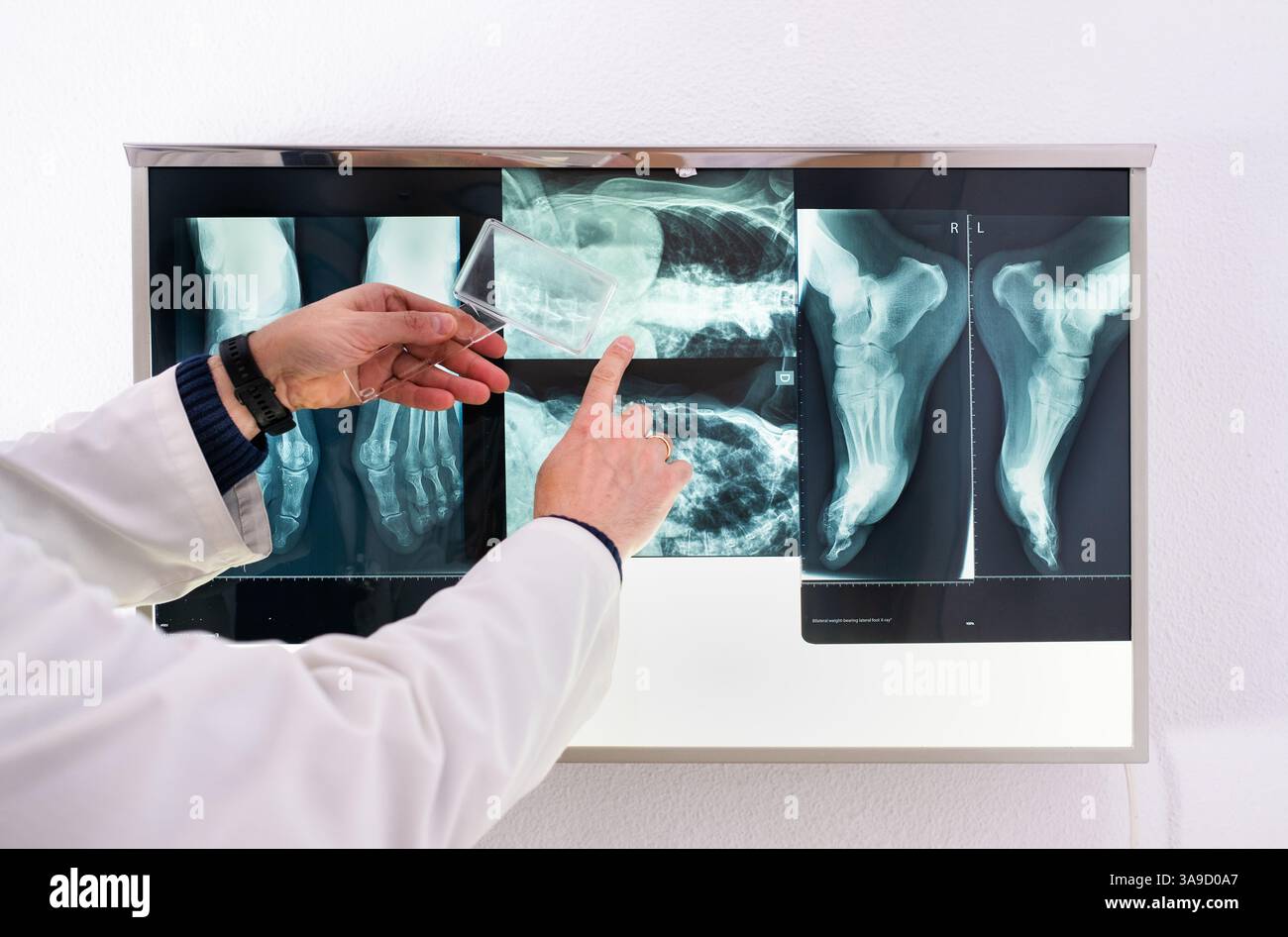 View of a viewing box in a health consultation room with several X-rays ...