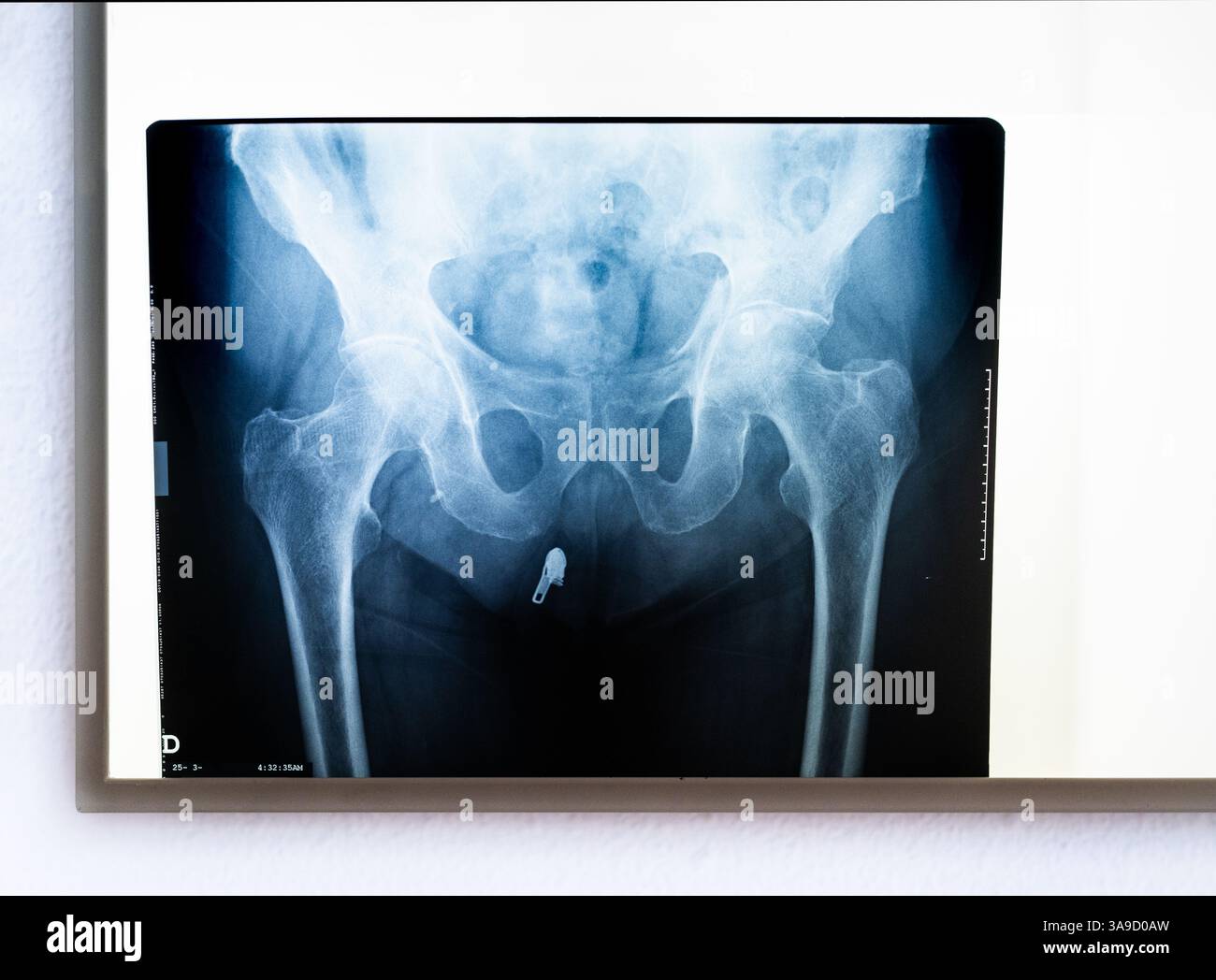 View in detail of a Viewing Box of radiographs of the consultation of a ...