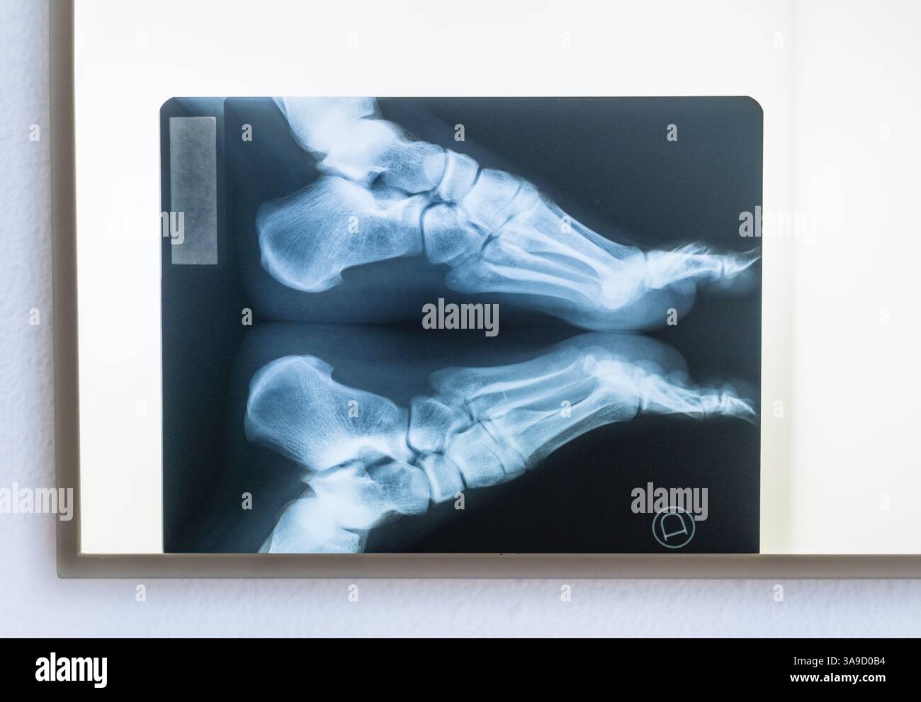 Detailed view of a viewing box with X-rays in the consultation of a ...