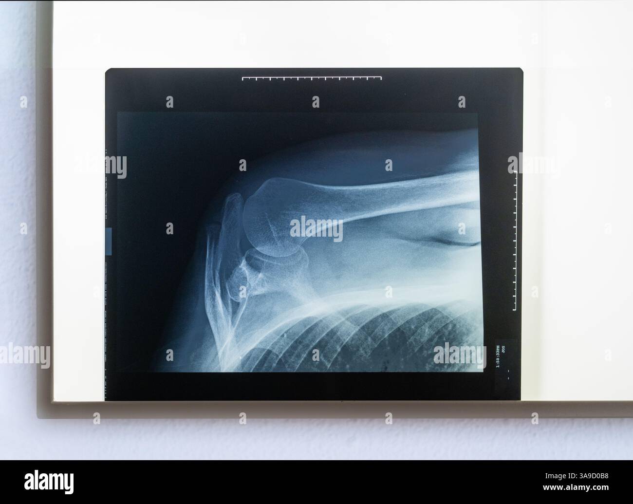 View in detail of a Viewing Box of radiographs of the consultation of a ...