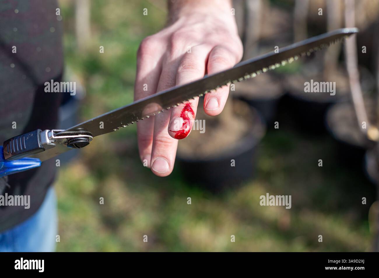 Finger injury with a cut wound caused by a hacksaw due to failure to ...