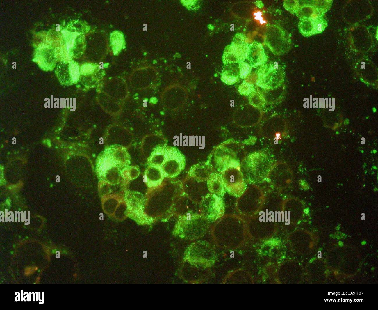 Apr 23, 2003; Beijing, CHINA; Picture of SARS viruses taken at the ...