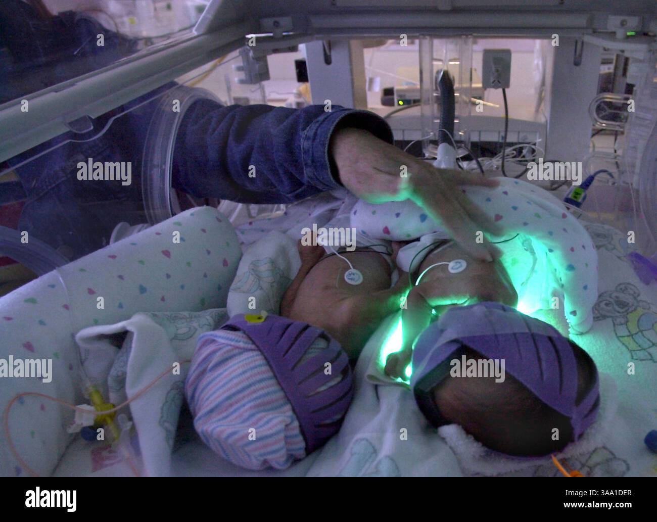 Bili light therapy hi-res stock photography and images - Alamy