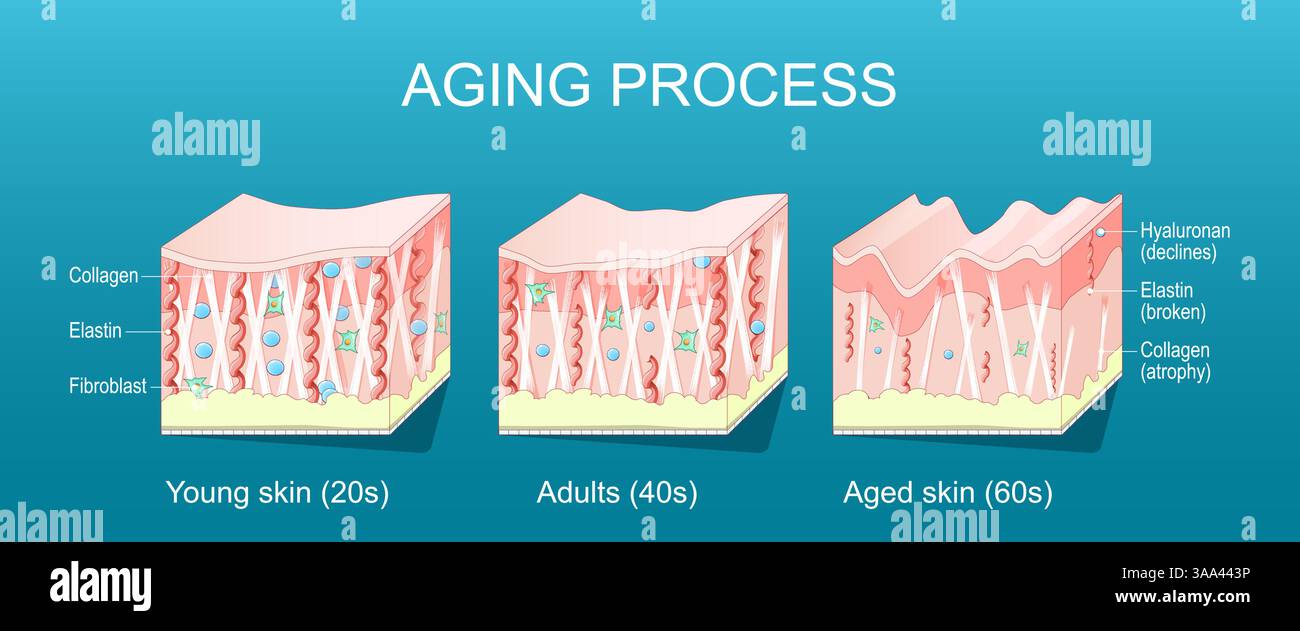 Aging process. Comparison of Young, Adults and aged skin. Collagen ...