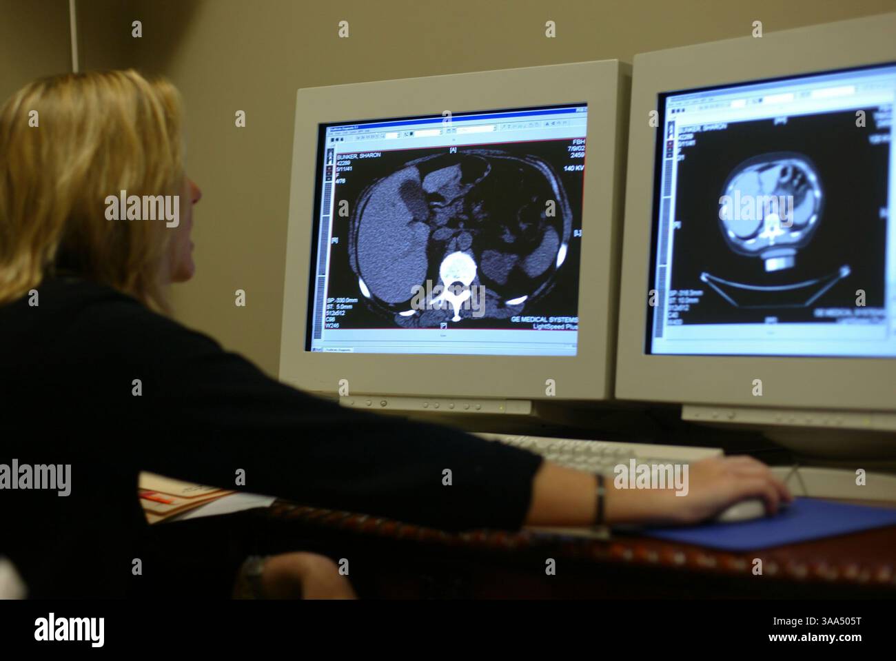 Ct scan brain normal hi-res stock photography and images - Alamy