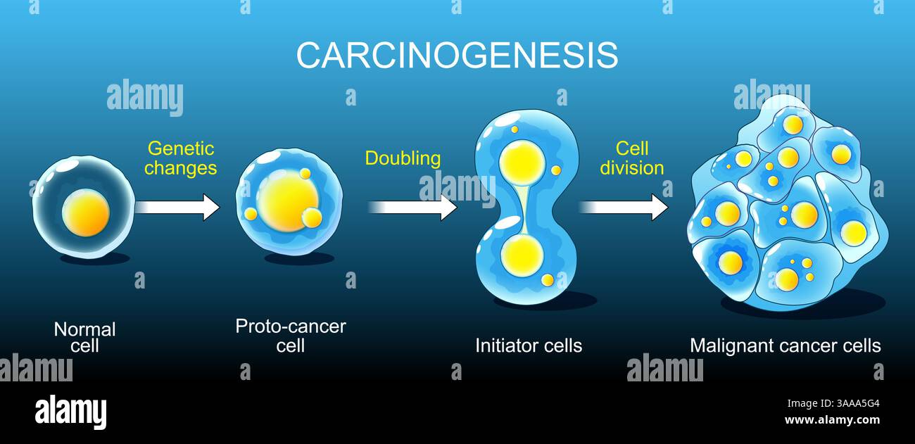 Oncogenesis. Cancer development. Carcinogenesis from Genetic mutations in normal cell to ...
