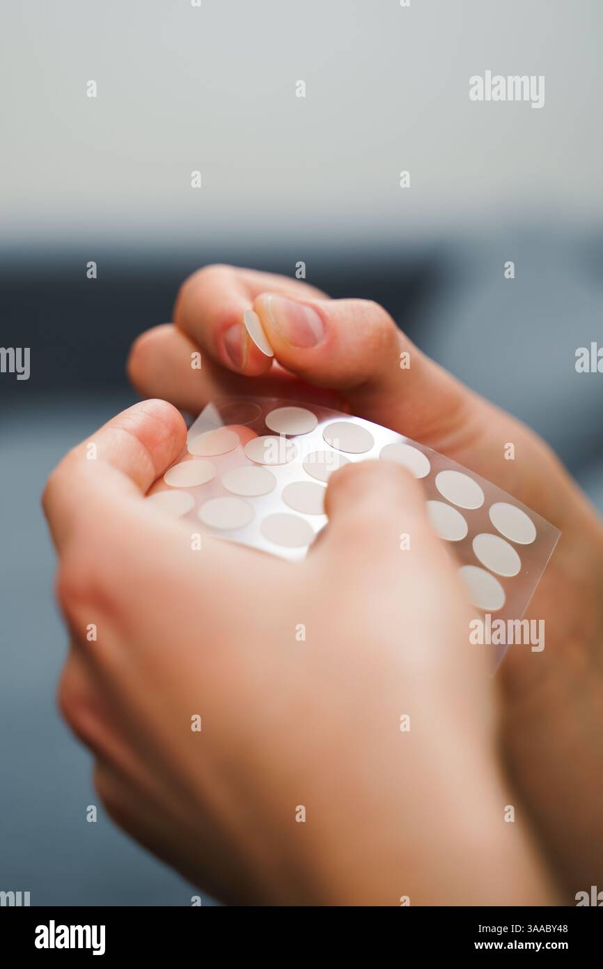 Cosmetic acne patches for pimple and rosacea treatment. Closeup of ...