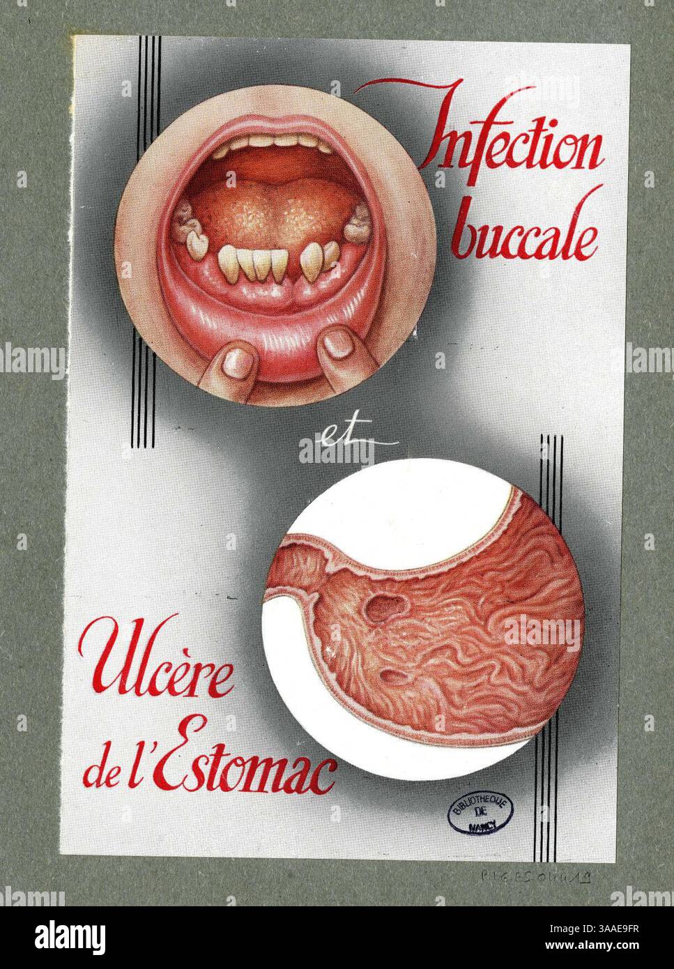 Buccale hi-res stock photography and images - Alamy