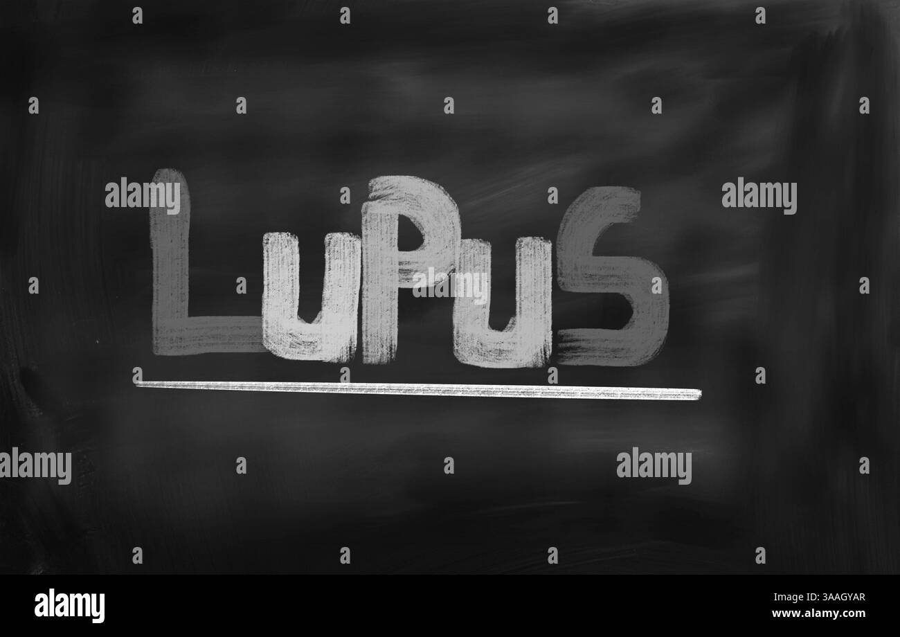 Lupus skin rash hi-res stock photography and images - Alamy