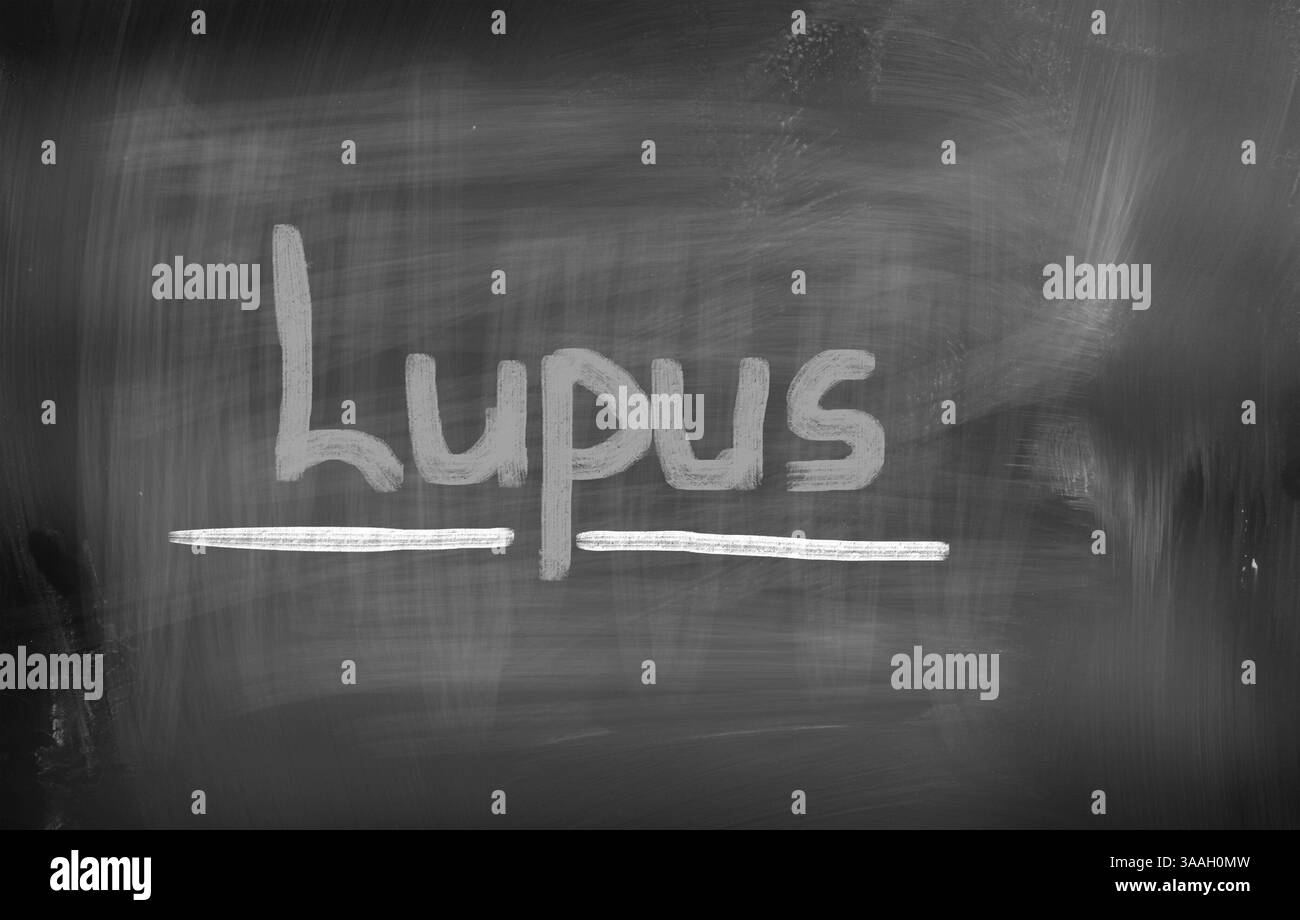 Lupus skin rash hi-res stock photography and images - Alamy