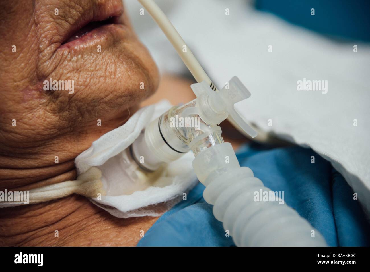 Patient asian elder women 80s do tracheostomy use ventilator for ...