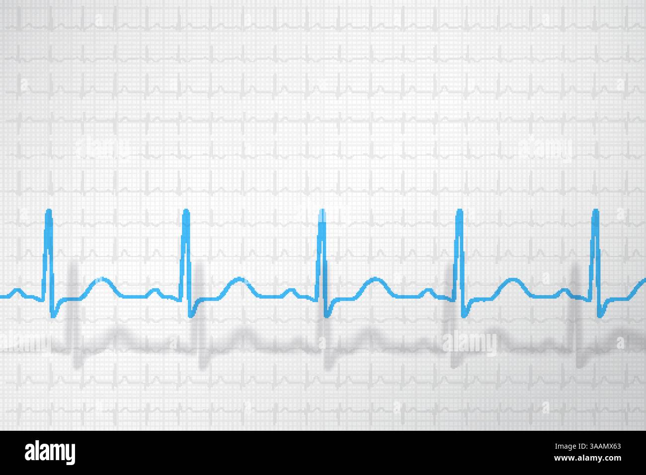 Normal ecg hi-res stock photography and images - Alamy