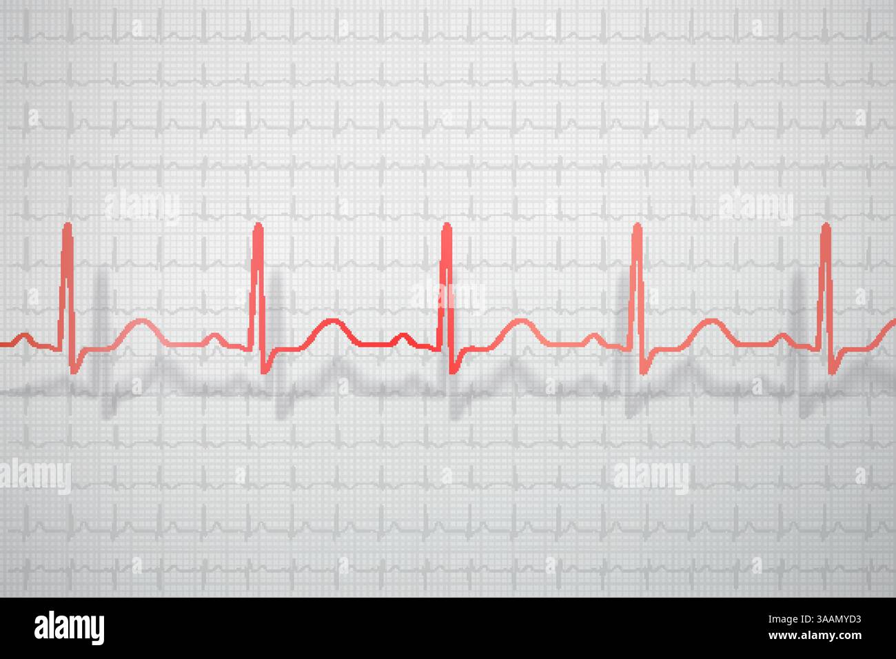 Dimensional ECG line with shadow on the graph paper Stock Vector Image ...