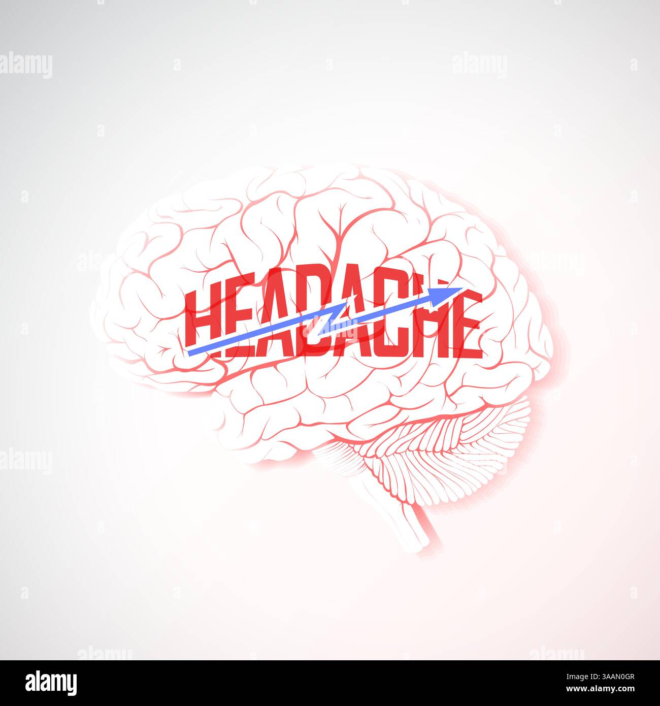 Vector image of a brain with lightning and the words "Headache Stock ...