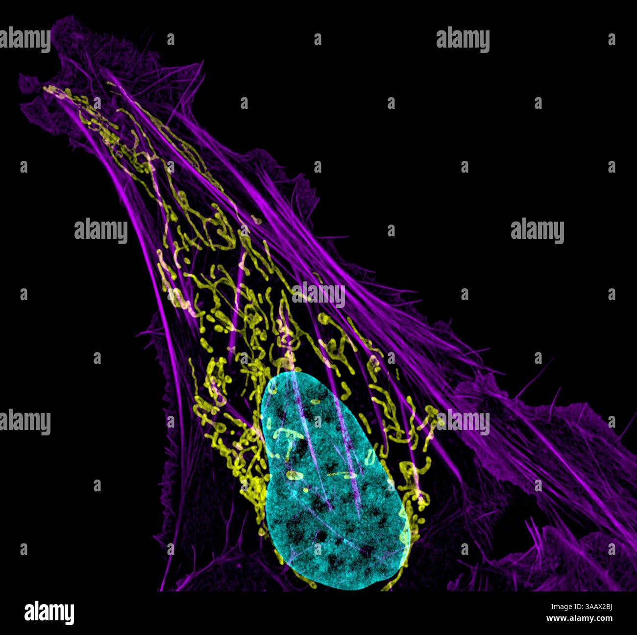 Bone cancer cell Stock Photo - Alamy