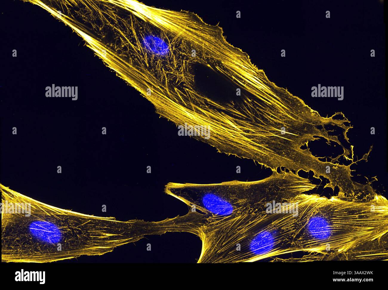 Immunofluorescence image of actin bundles in muscle precursor cells ...