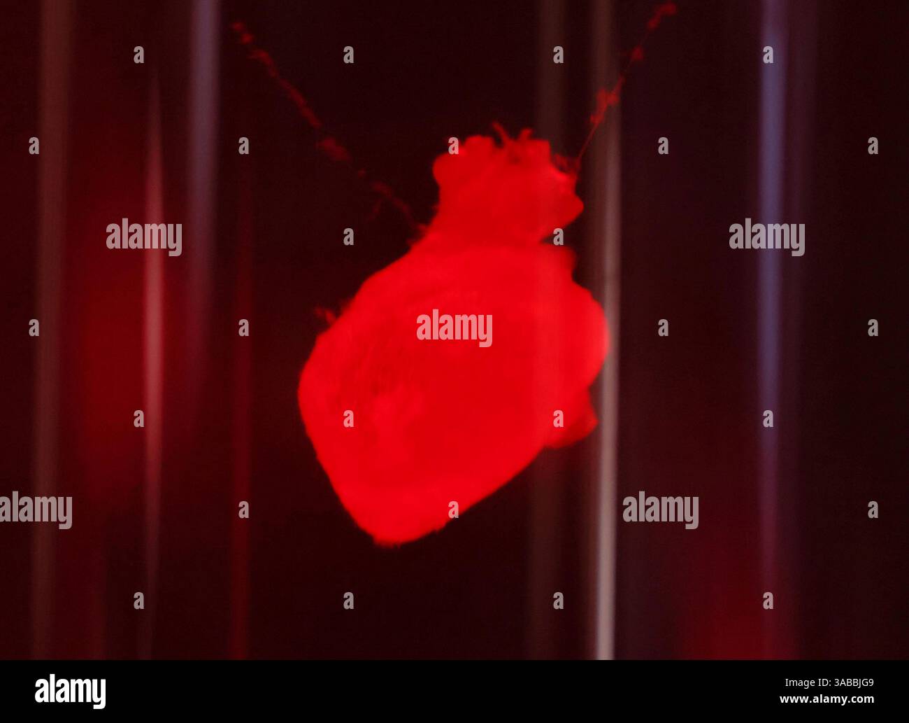 A photo shows the "iPS heart" developed by Yoshiki Sawa at Pasona ...