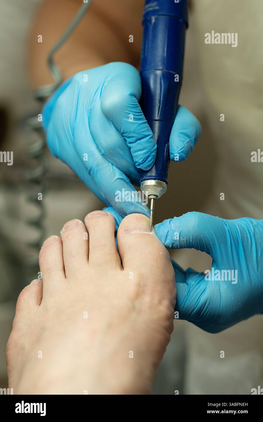 Gloved technician works on toenails using rotary file for shaping ...