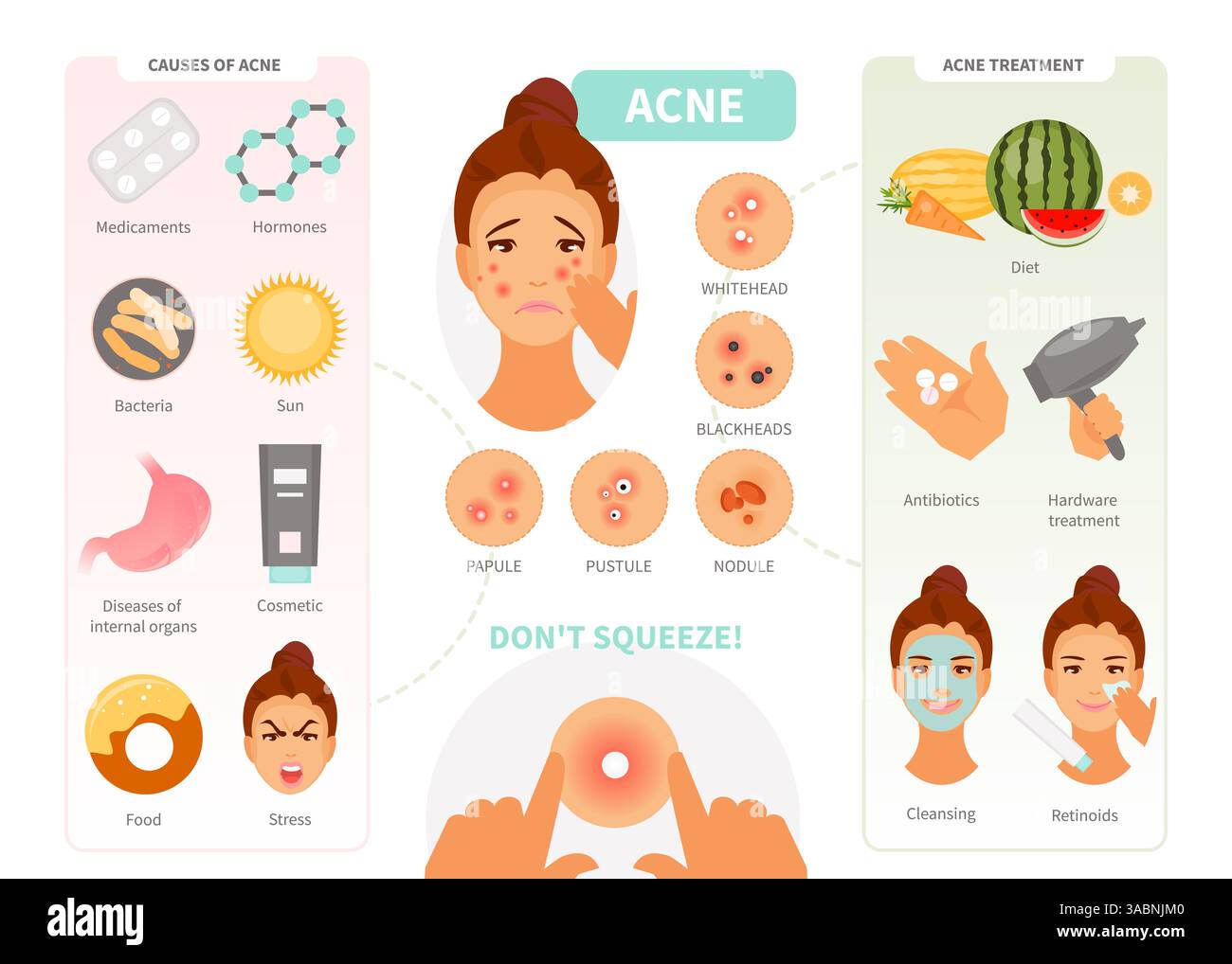 Types, causes and treatment of acne. Vector infographic Stock Vector ...