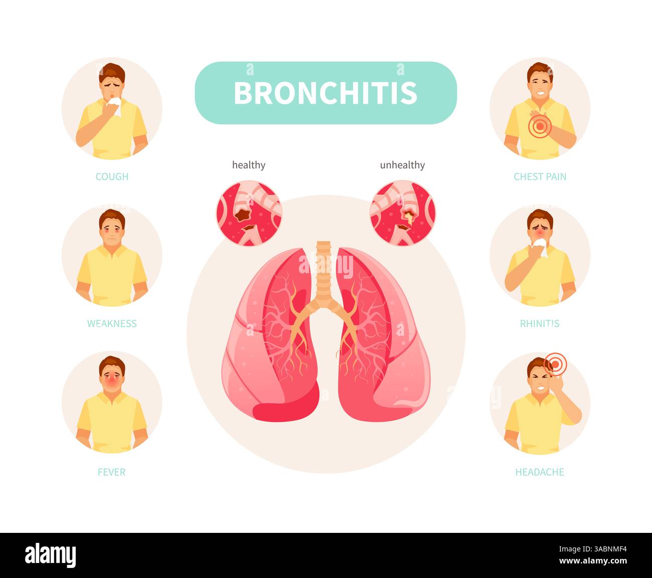 Bronchitis disease. Symptoms and scheme of the lungs with inflammation ...
