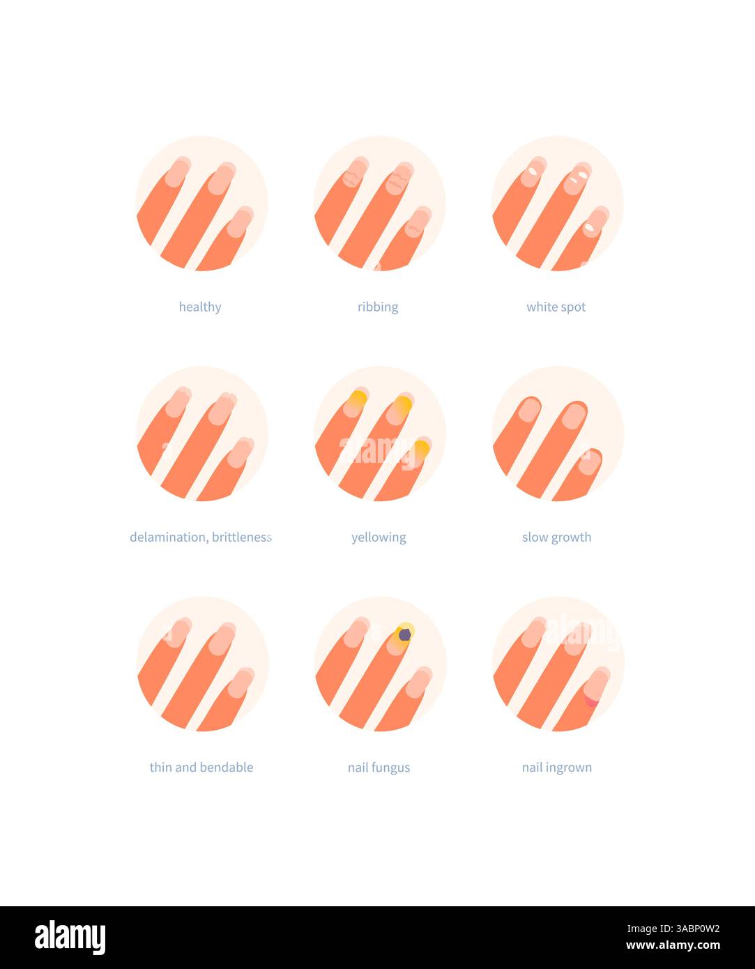 Set nails with different problems. Vector medical illustration, poster ...