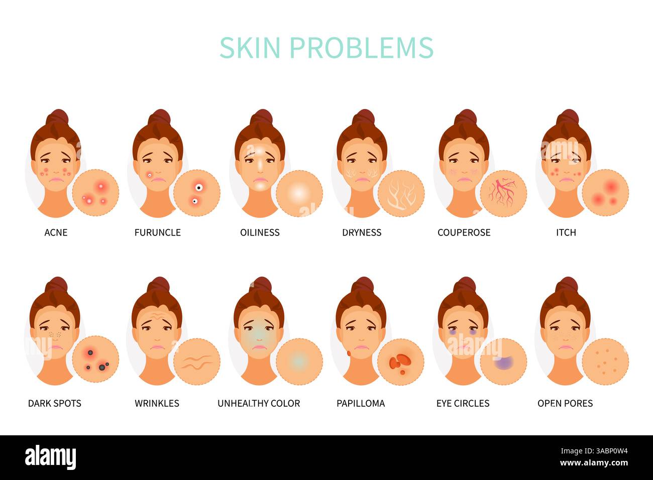 Various skin problems. Dermatology and cosmetology. Vector illustration ...