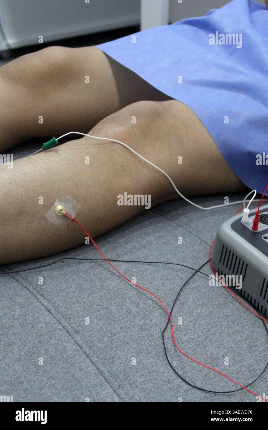 Electromyography and somatosensory evoked potentials in the legs of a ...