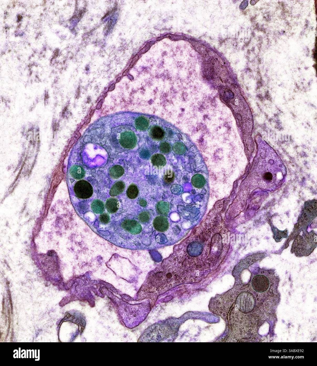 Platelet. Coloured transmission electron micrograph (TEM) of a platelet ...