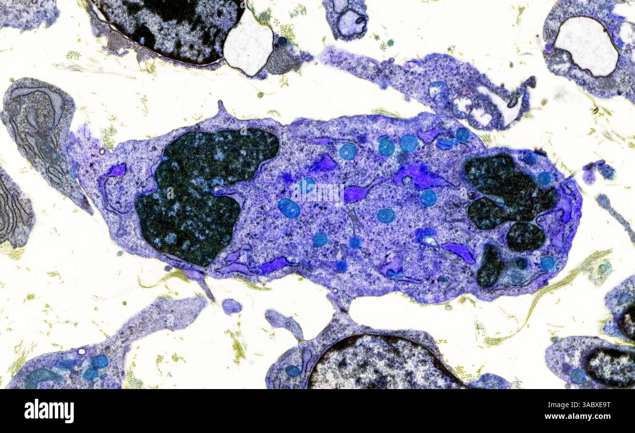 Mitosis. Transmission electron micrograph (TEM) of a section through a ...